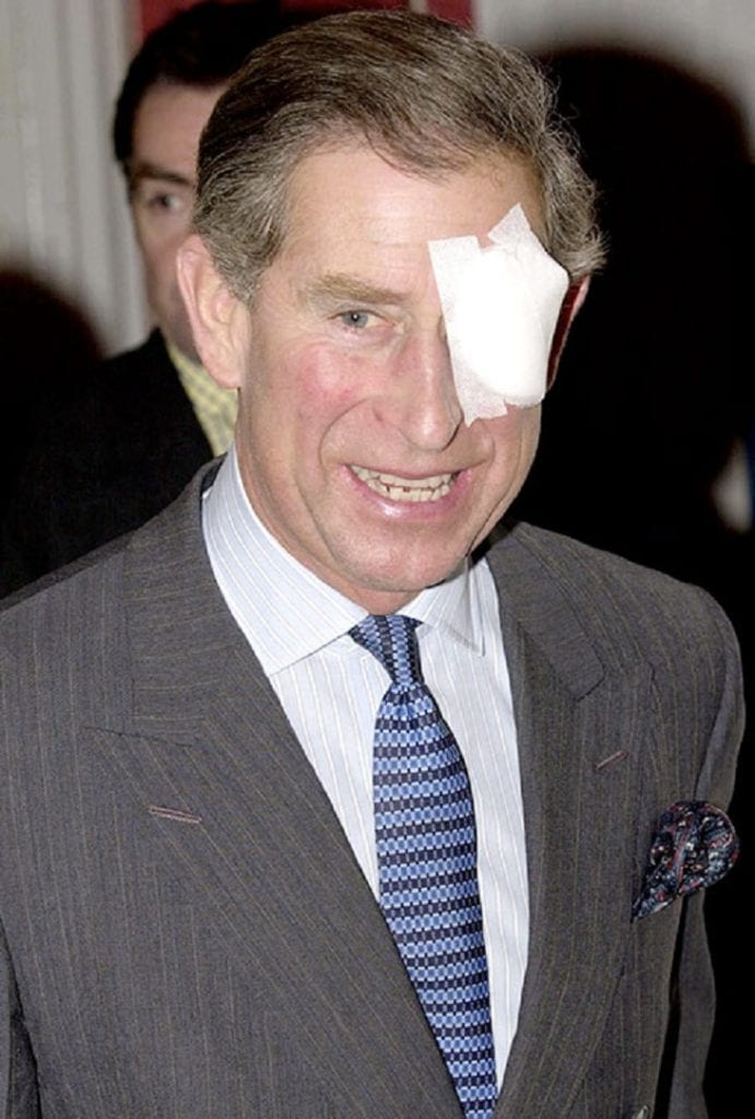 When Members of the Royal Family Suffered Various Injuries - The Frisky