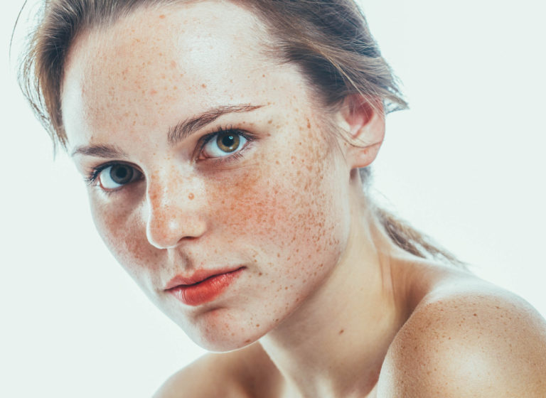 Sun Exposure Effects on Your Skin - The Frisky