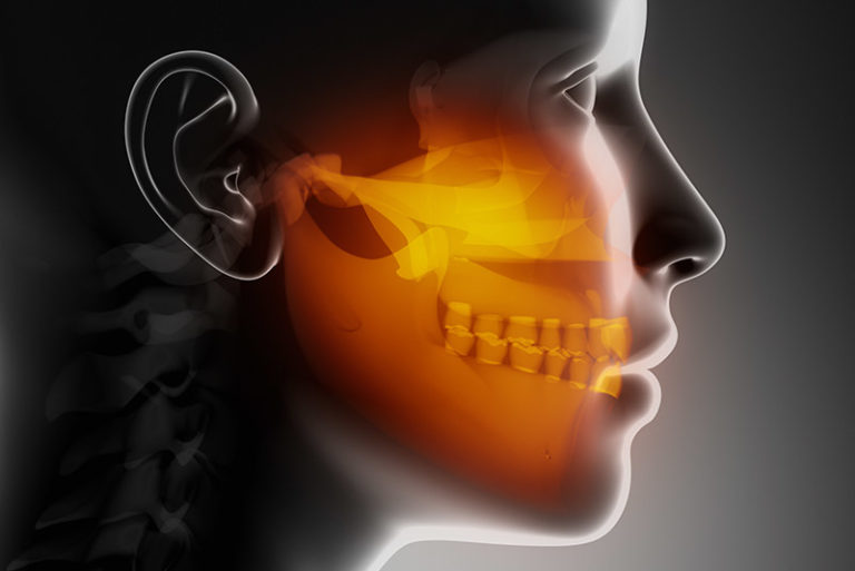 I Have TMJD - The Frisky