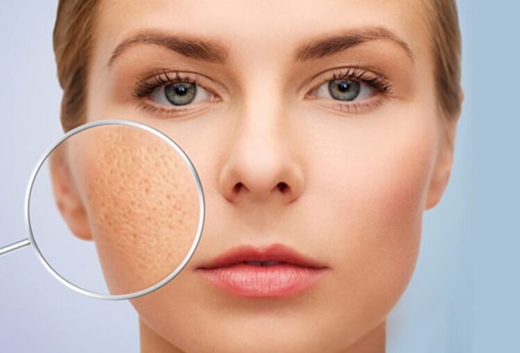 Minimizing Large Pores – What are Your Options? - The Frisky