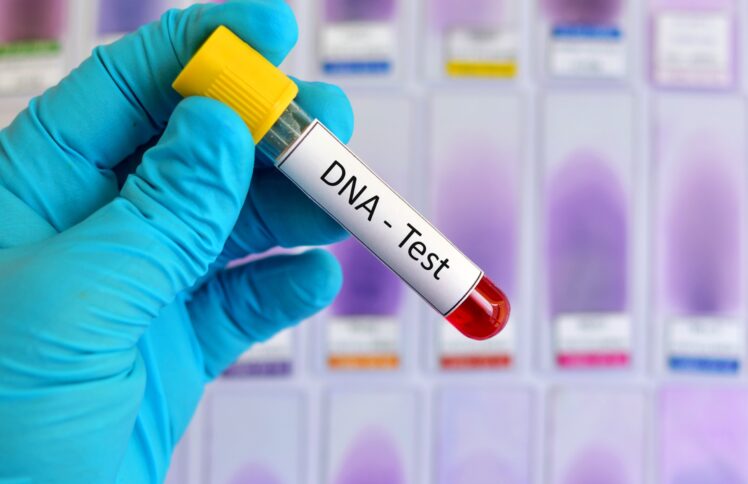 How Accurate is a DNA Test? - The Frisky