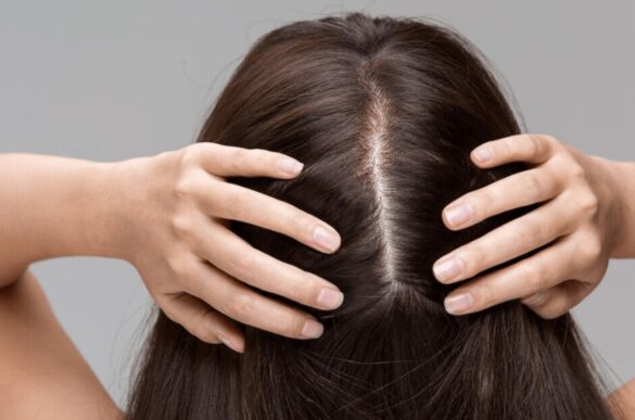 6 Causes of Hair Loss and How to Treat It - The Frisky