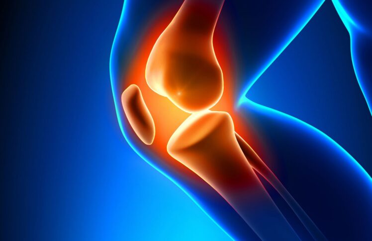 How To Tell If Knee Pain Is Serious & What You Should Do - The Frisky