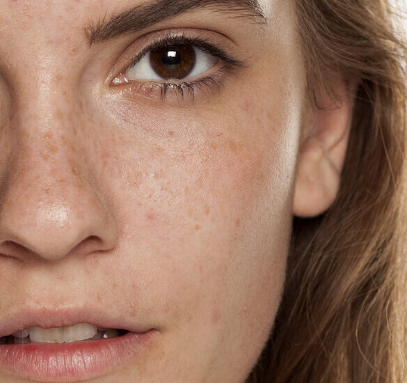 Everything You Need To Know About Skin Bleaching - The Frisky