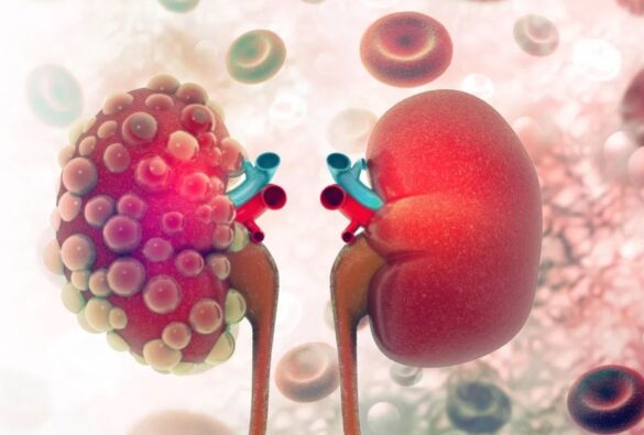 Is Coffee Good or Bad For Your Kidneys? - The Frisky