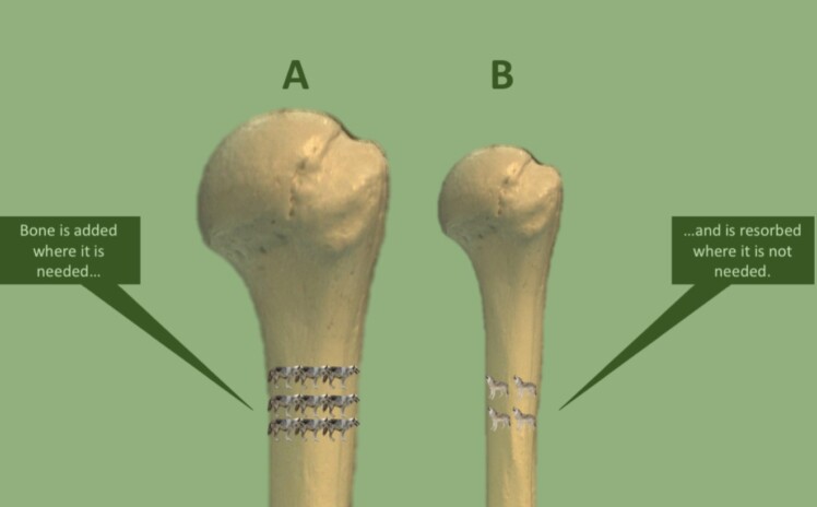 What is Wolff’s Law and How is it Related to Posture and ...