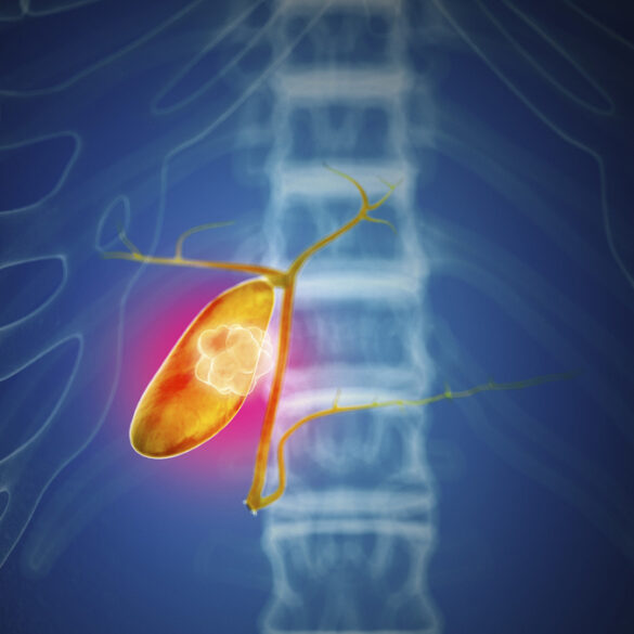 What Is The Prostate And How To Keep It Healthy - The Frisky