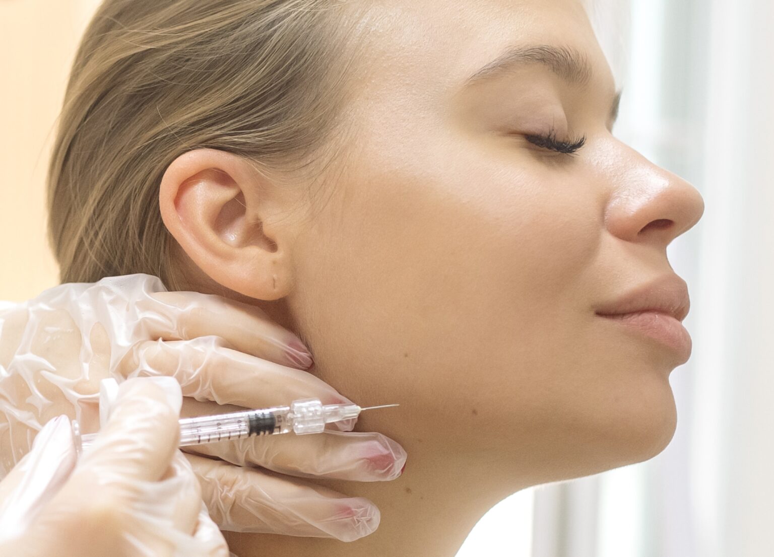 Top 3 Facial Areas for Injecting Botox: Cheek Lines, Forehead Lines ...